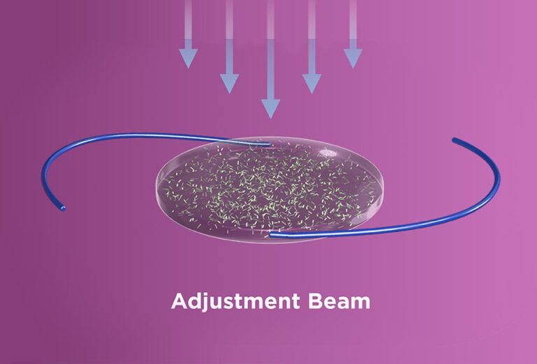 RxSight Light Adjustable Lens Los Angeles | Barry Seibel, MD