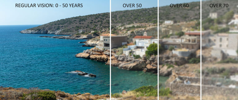 Cataracts in Los Angeles | Barry Seibel, MD | Seibel Vision Surgery